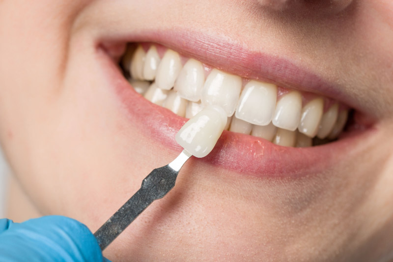 Zahnarzt Köln | AllDent Zahnzentrum Köln